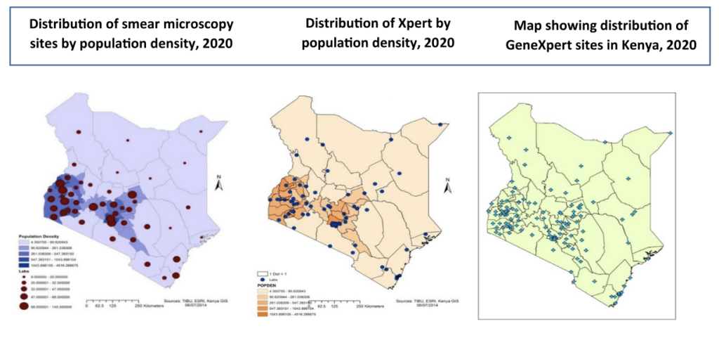 Tuberculosis in Kenya - CHS: Centre for Health Solutions - Kenya